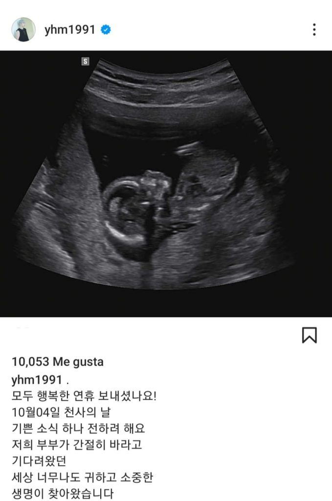 Hoon de U-KISS y Hwang Ji Seon, ex Girl's Day, esperan su primer hijo